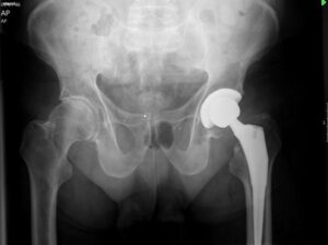 Behandelingen - Orthopedie Breda