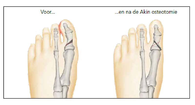 Behandelingen - Orthopedie Breda