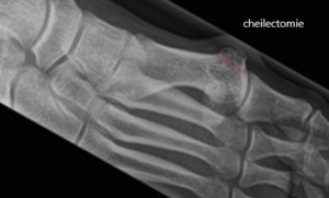 Behandelingen - Orthopedie Breda